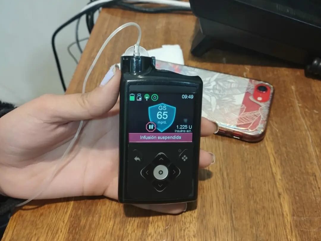 Comienza renovación de bombas de insulina para pacientes diabéticos en ...